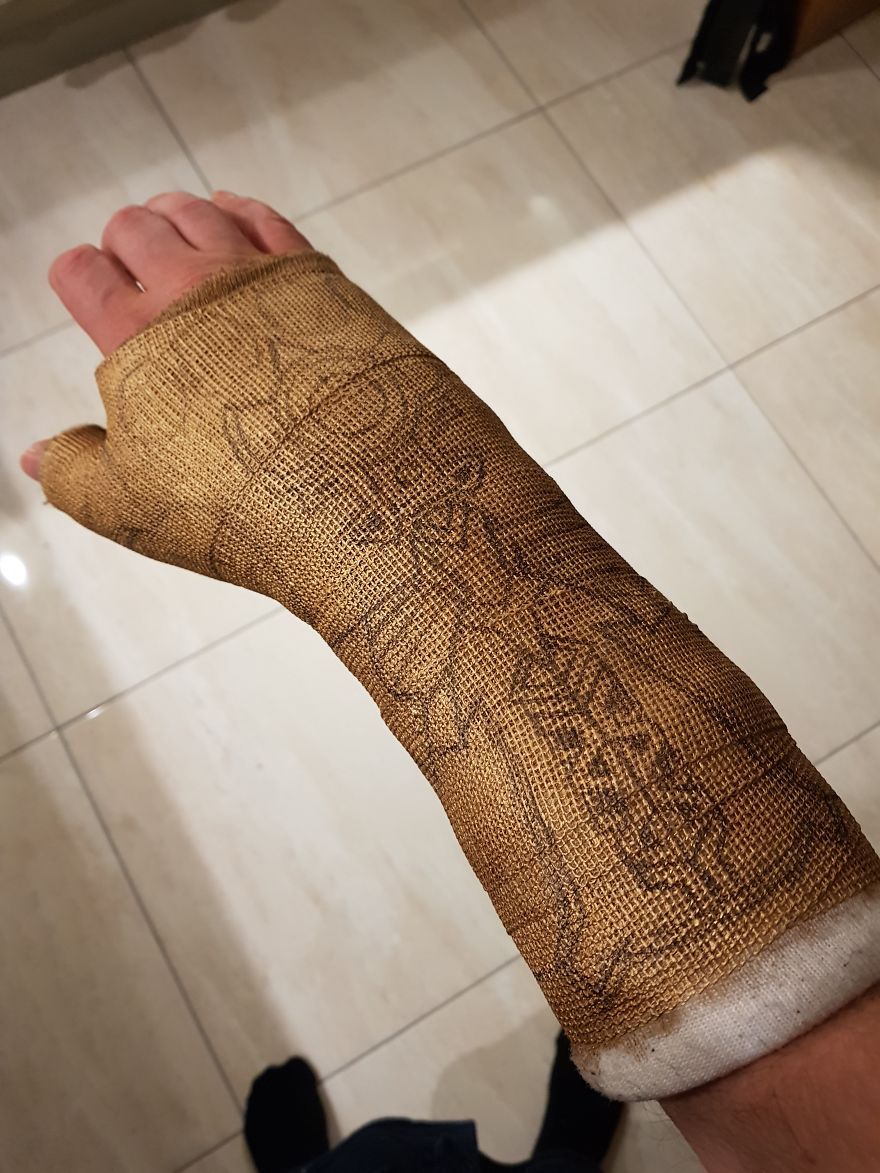 After Breaking My Wrist, I Turned My Plain Cast Into Thanos‘ Infinity ...
