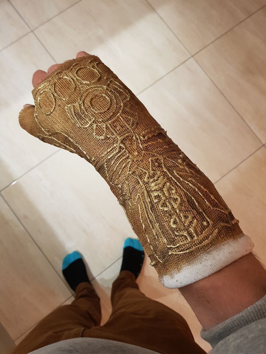 After Breaking My Wrist, I Turned My Plain Cast Into Thanos‘ Infinity ...